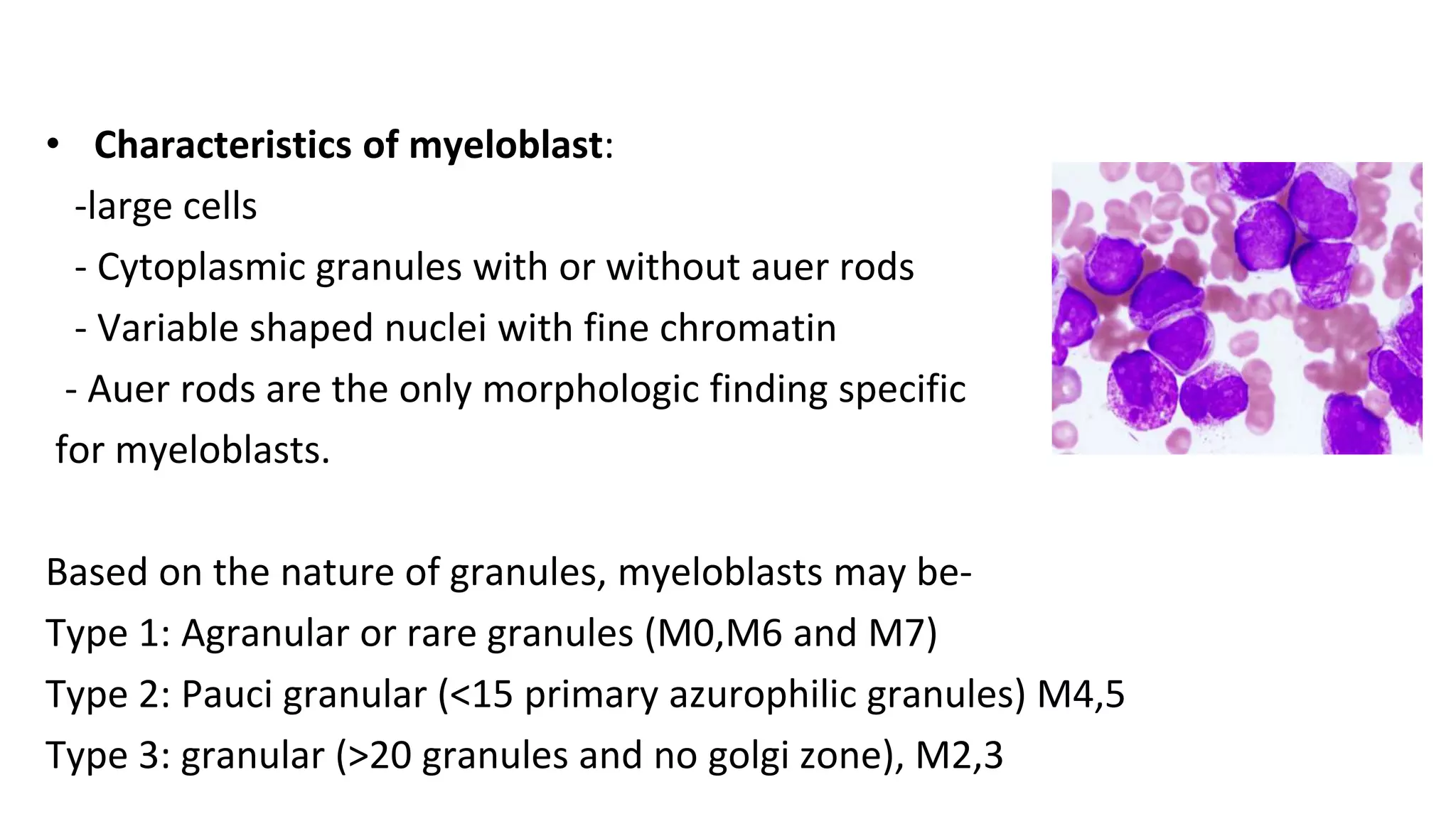 Childhood Acute Leukemia.pptx
