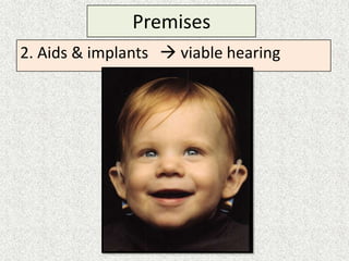 Childhood hearing loss and the development of spoken language | PPTX