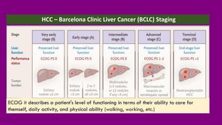 Childhood hepatocellular carcinoma.pdf