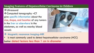 Childhood hepatocellular carcinoma.pdf
