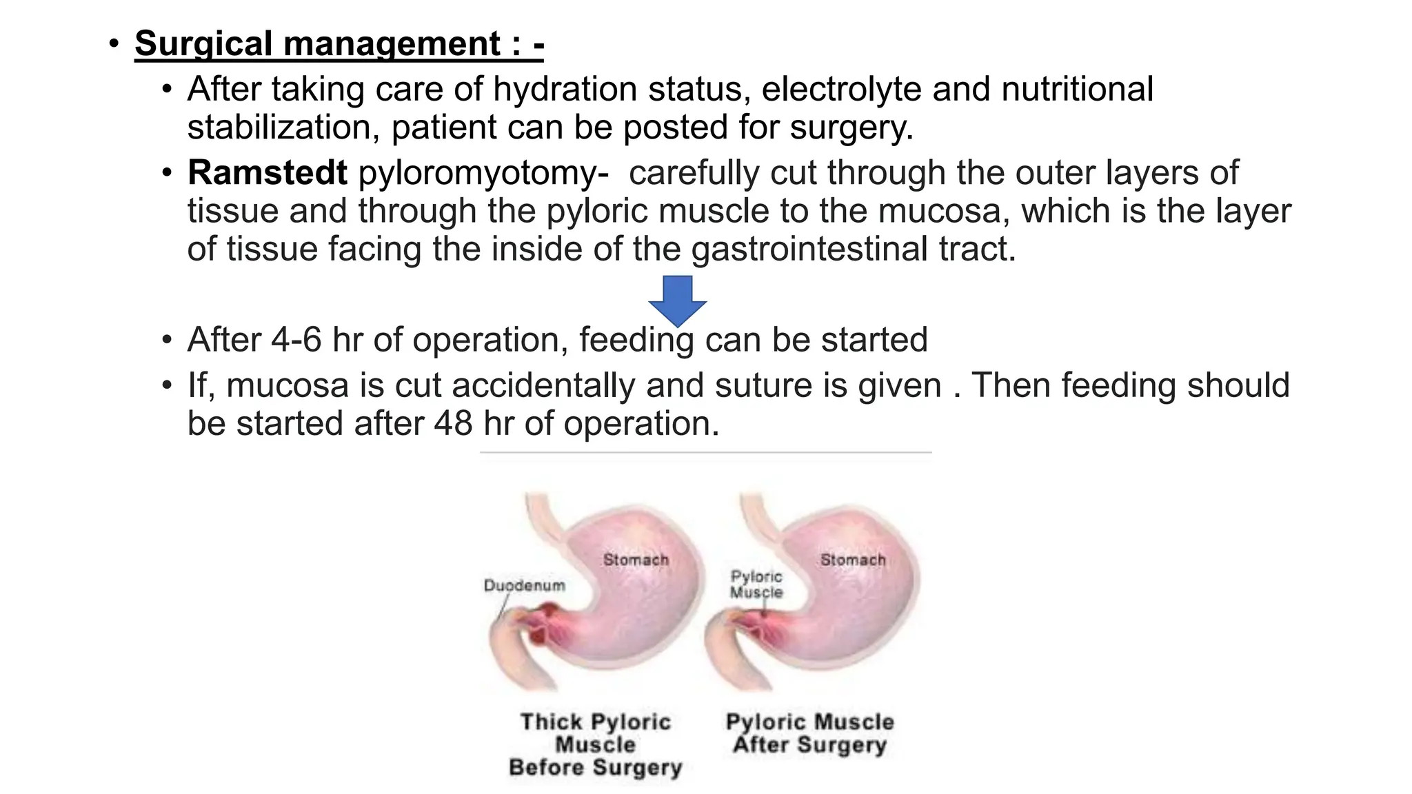 childhood intestinal obstruction.pptx | Pregnancy | Reproductive Health