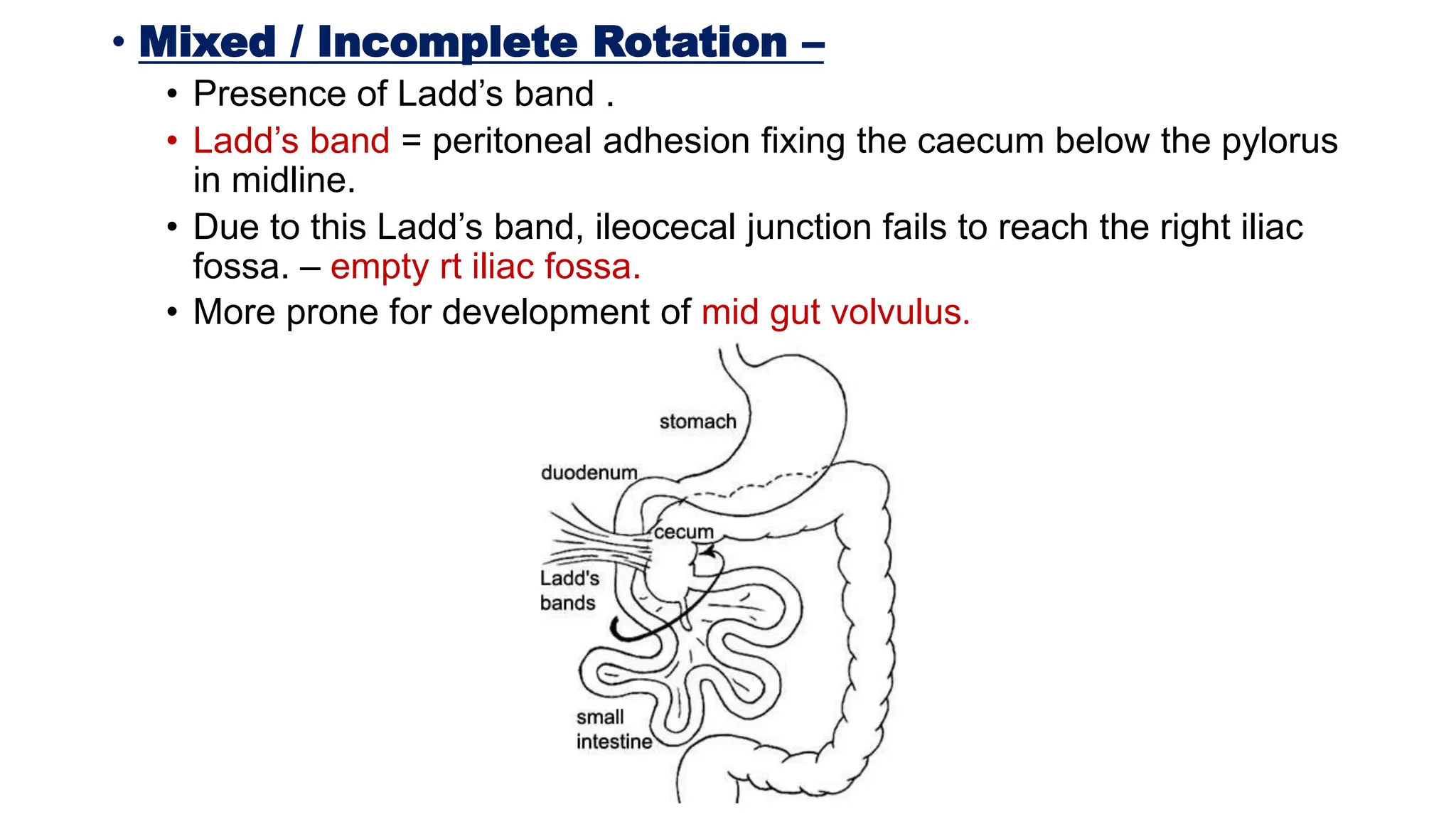 childhood intestinal obstruction.pptx | Pregnancy | Reproductive Health