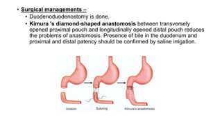 childhood intestinal obstruction.pptx