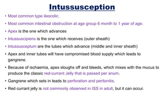 childhood intestinal obstruction.pptx | Pregnancy | Reproductive Health