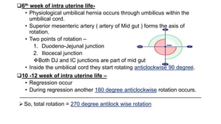 childhood intestinal obstruction.pptx | Pregnancy | Reproductive Health
