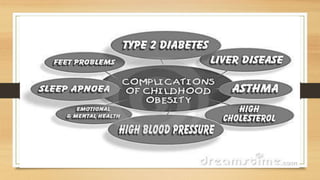 Childhood obesity | PPTX
