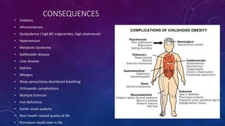 Childhood obesity | PPTX