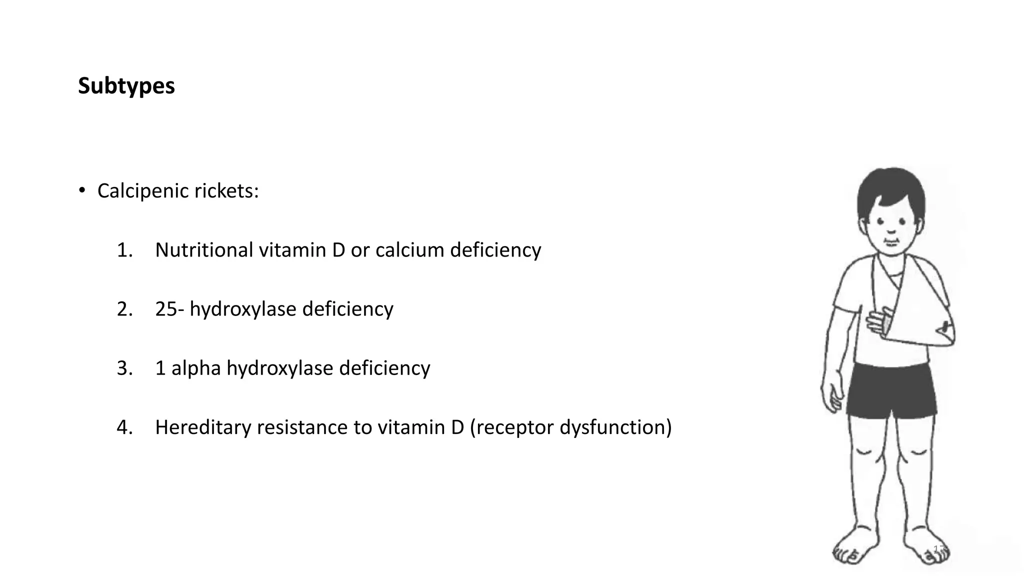An Overview of Childhood Rickets | PPTX