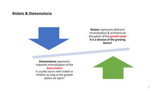 An Overview of Childhood Rickets | PPTX