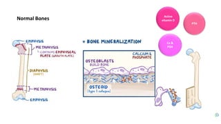 An Overview of Childhood Rickets | PPTX | Endocrine and Metabolic ...