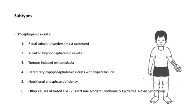 An Overview of Childhood Rickets | PPT