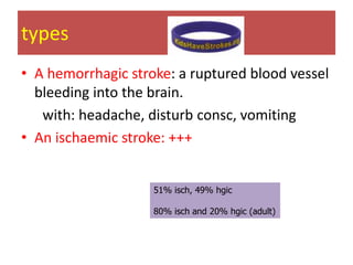 Childhood stroke ped neurology view | PPTX