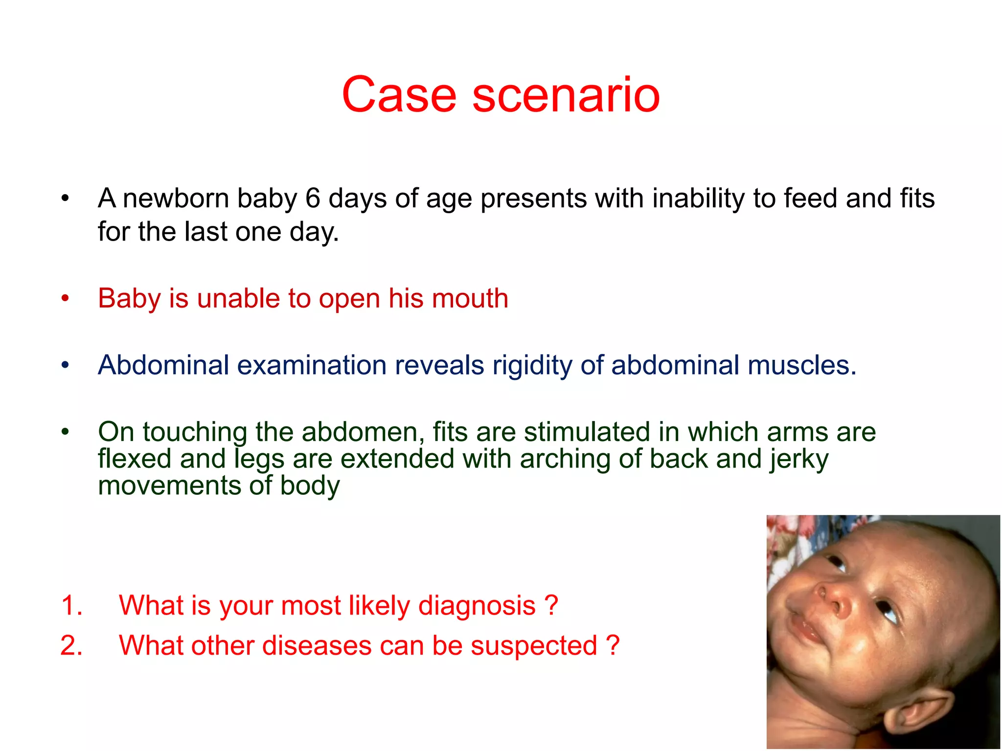 Childhood tetanus 2021 | PDF