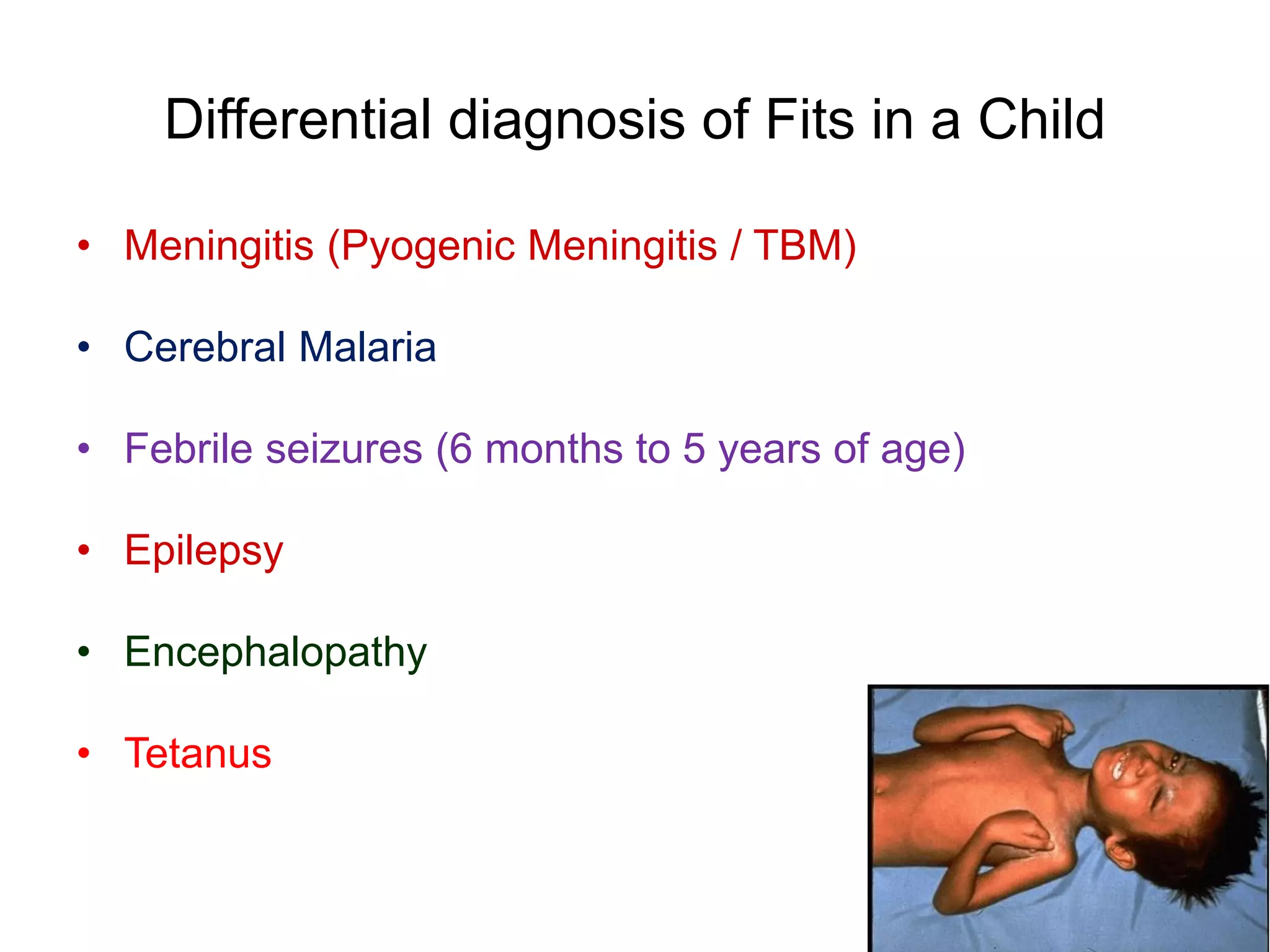 Childhood tetanus 2021 | PDF