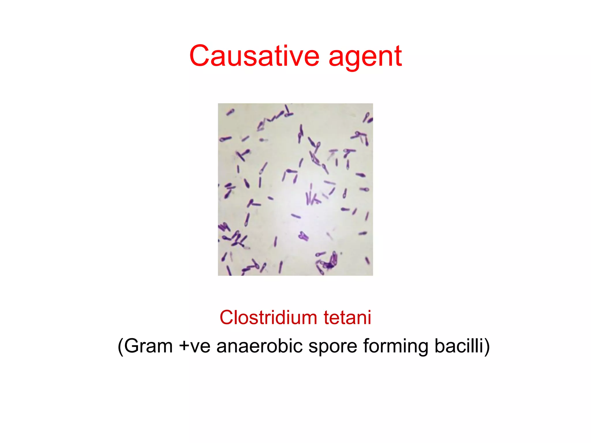 Childhood tetanus 2021 | PDF