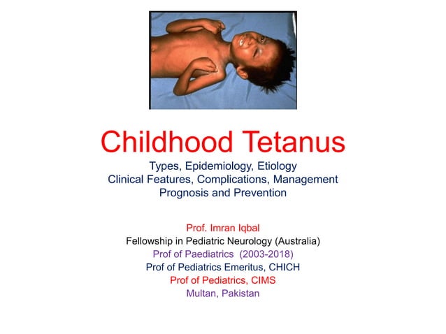 Childhood tetanus 2021 | PDF