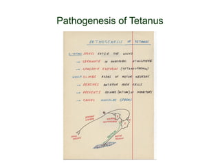 Childhood tetanus 2021 | PDF