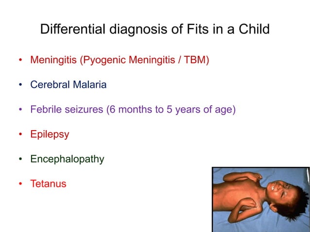 Childhood tetanus 2021 | PDF