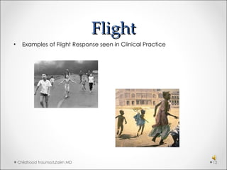 Childhood Trauma Presentation 2 | PPT