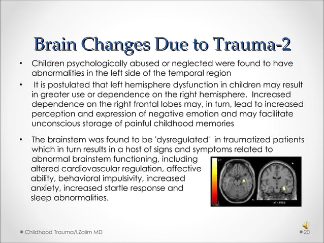 Childhood Trauma Presentation 2 | PPT