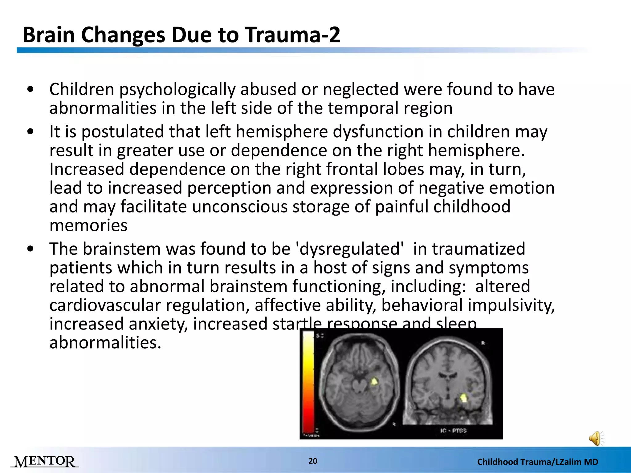 Childhood Trauma Presentation | PPT