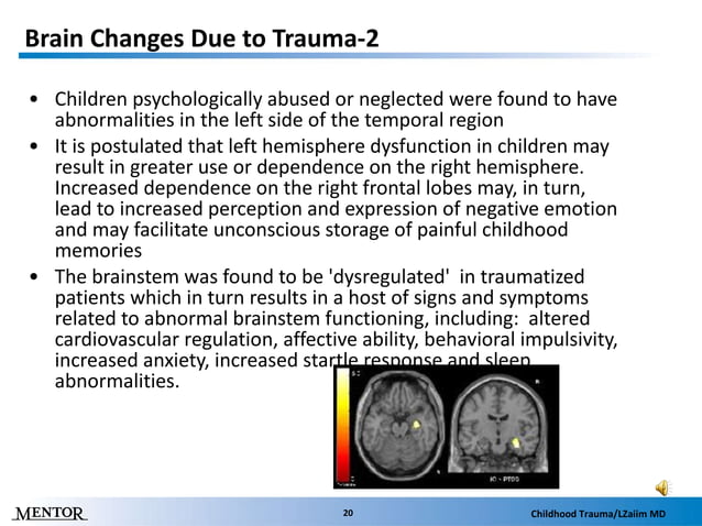 Childhood Trauma Presentation | PPT | Brain and Nervous System ...