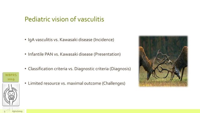 Childhood vasculitis | PPT
