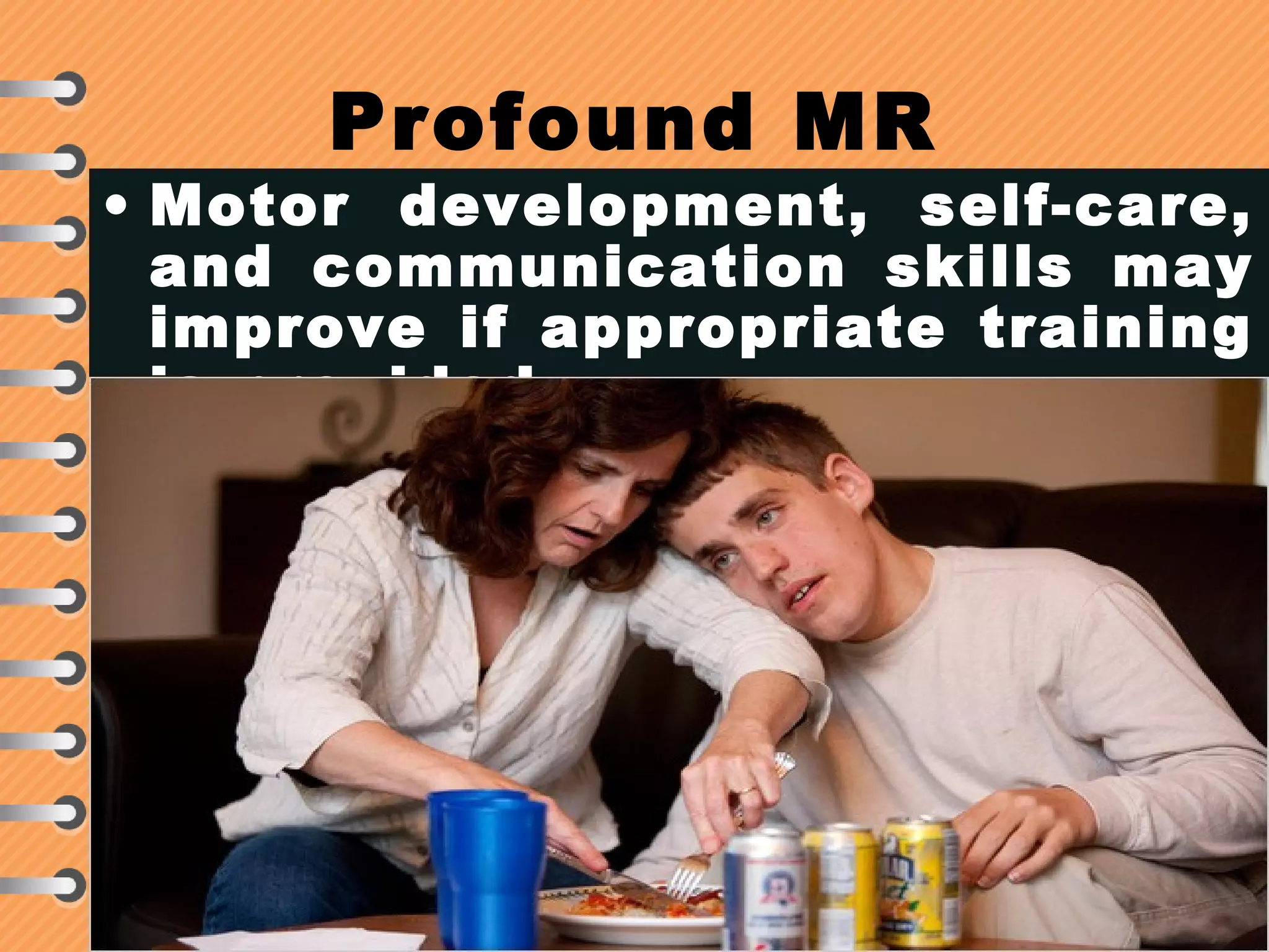 Mental Retardation and other child psychiatric disorders | PPT