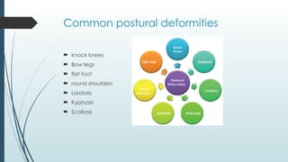 CHILDREN AND WOMEN IN SPORTS POSTRAL DEFORMITIES.pptx