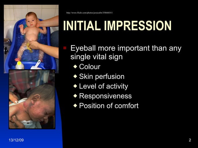 Children are Different | PPT