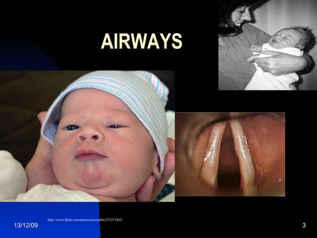 Children are Different | PPT