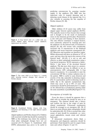 Children's hip | PDF