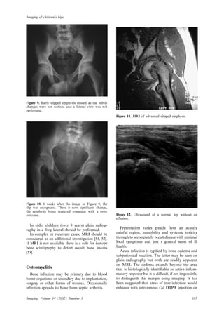 Children's hip | PDF