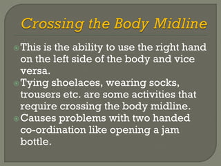 Children with developmental coordination disorders dcd | PDF