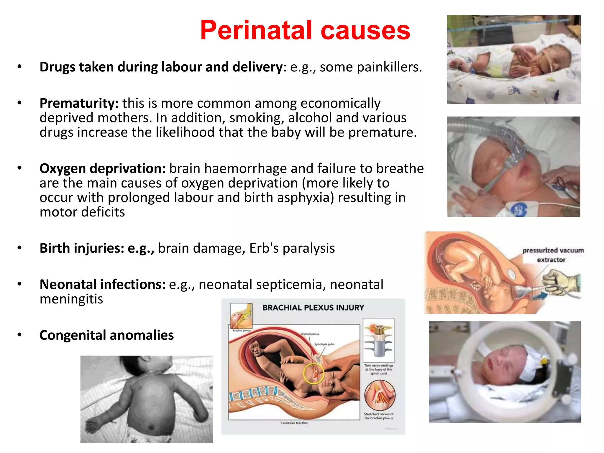 Children with disabilities | PPTX