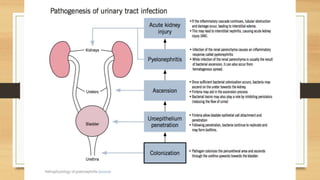 Children with Genito urinary disorders.pptx | Infectious Diseases ...