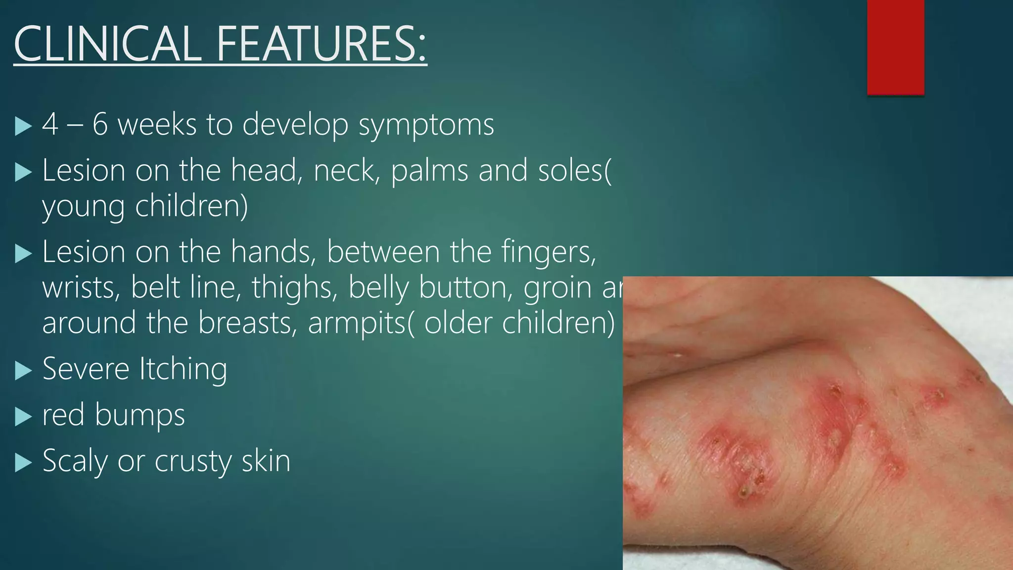 Children with integumentry disorders | PPTX