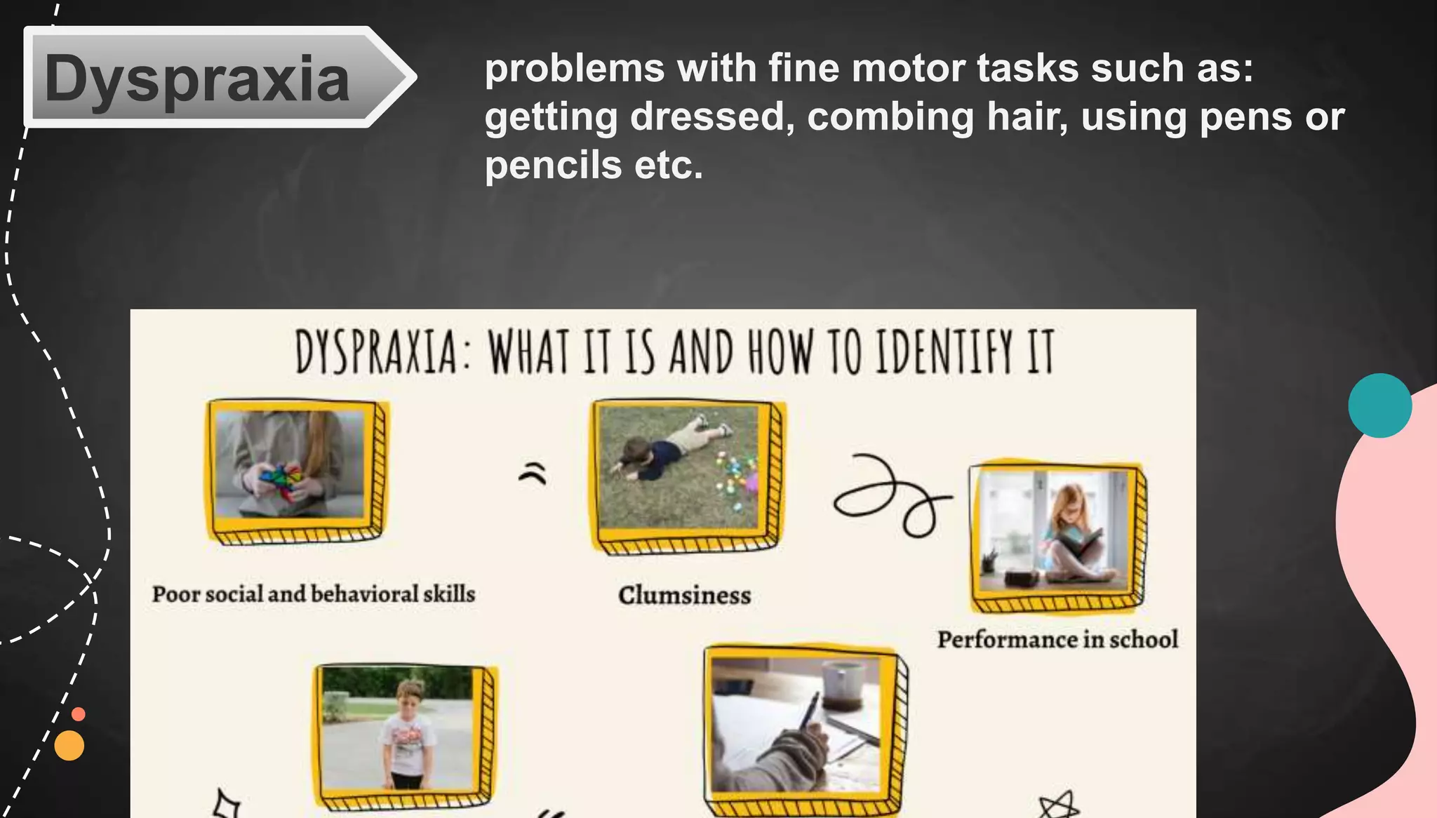 Children with special needs Inclusive Education | PPTX