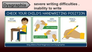 Children with special needs Inclusive Education | PPTX