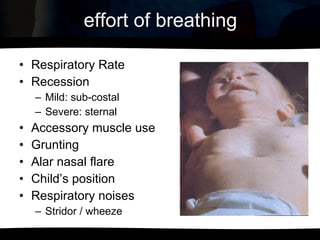 Recognising the child with respiratory distress | PPT