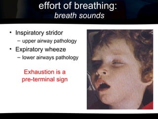 Recognising the child with respiratory distress | PPT