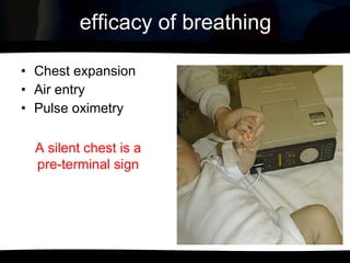 Recognising the child with respiratory distress | PPT