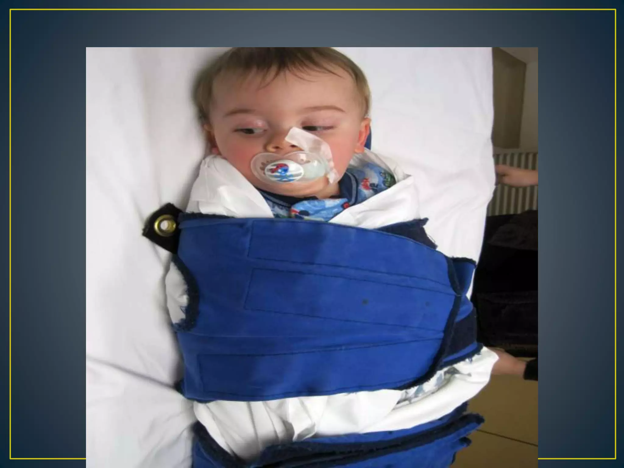 Child rrestraints | PPTX