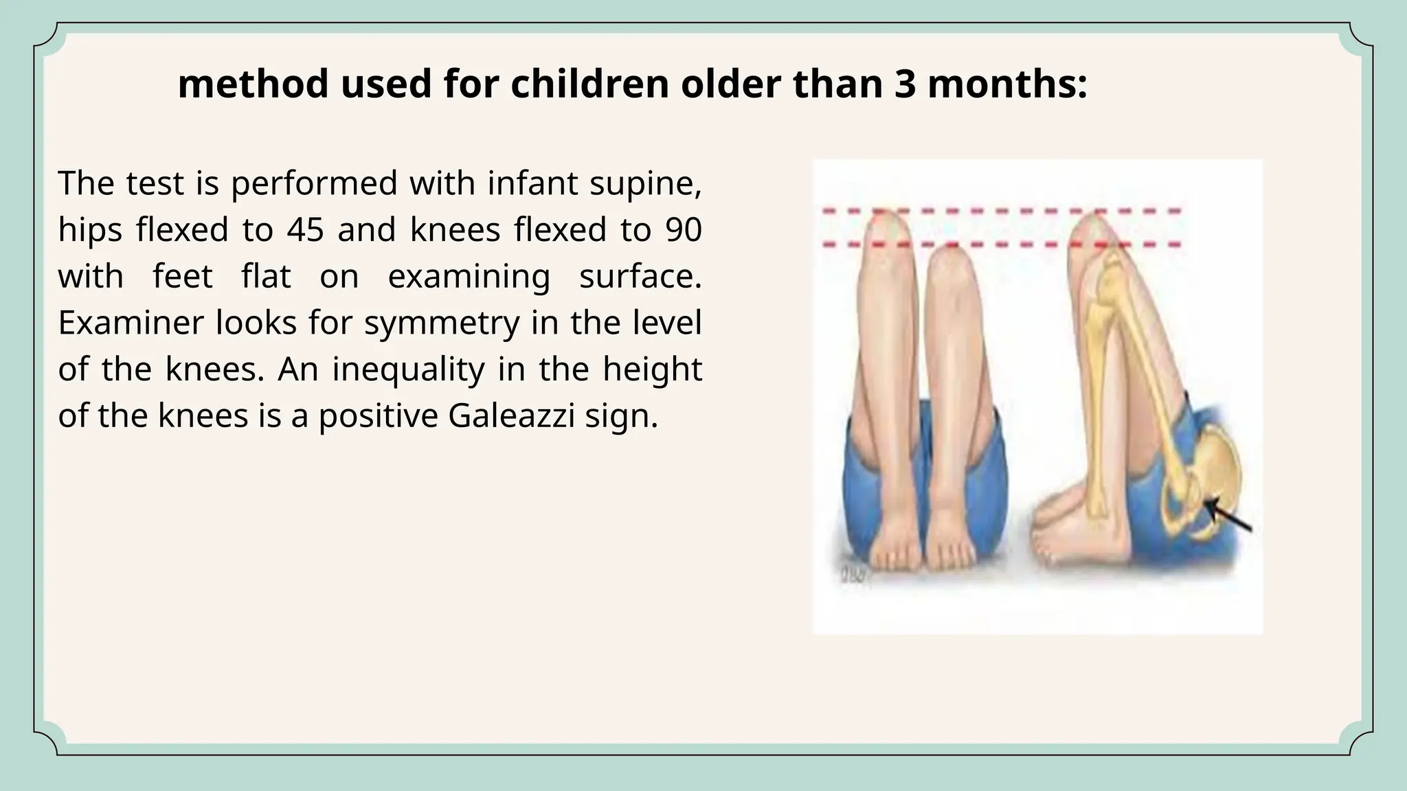 CHILD skeletal system and their diseases.pptx