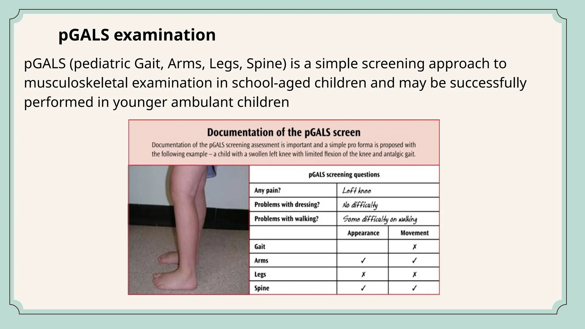 CHILD skeletal system and their diseases.pptx