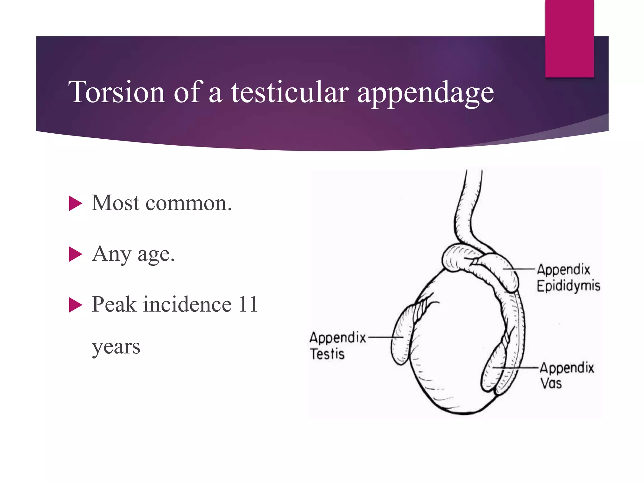 Child with acute scrotum | PPTX
