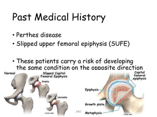Child with a limp | PPTX