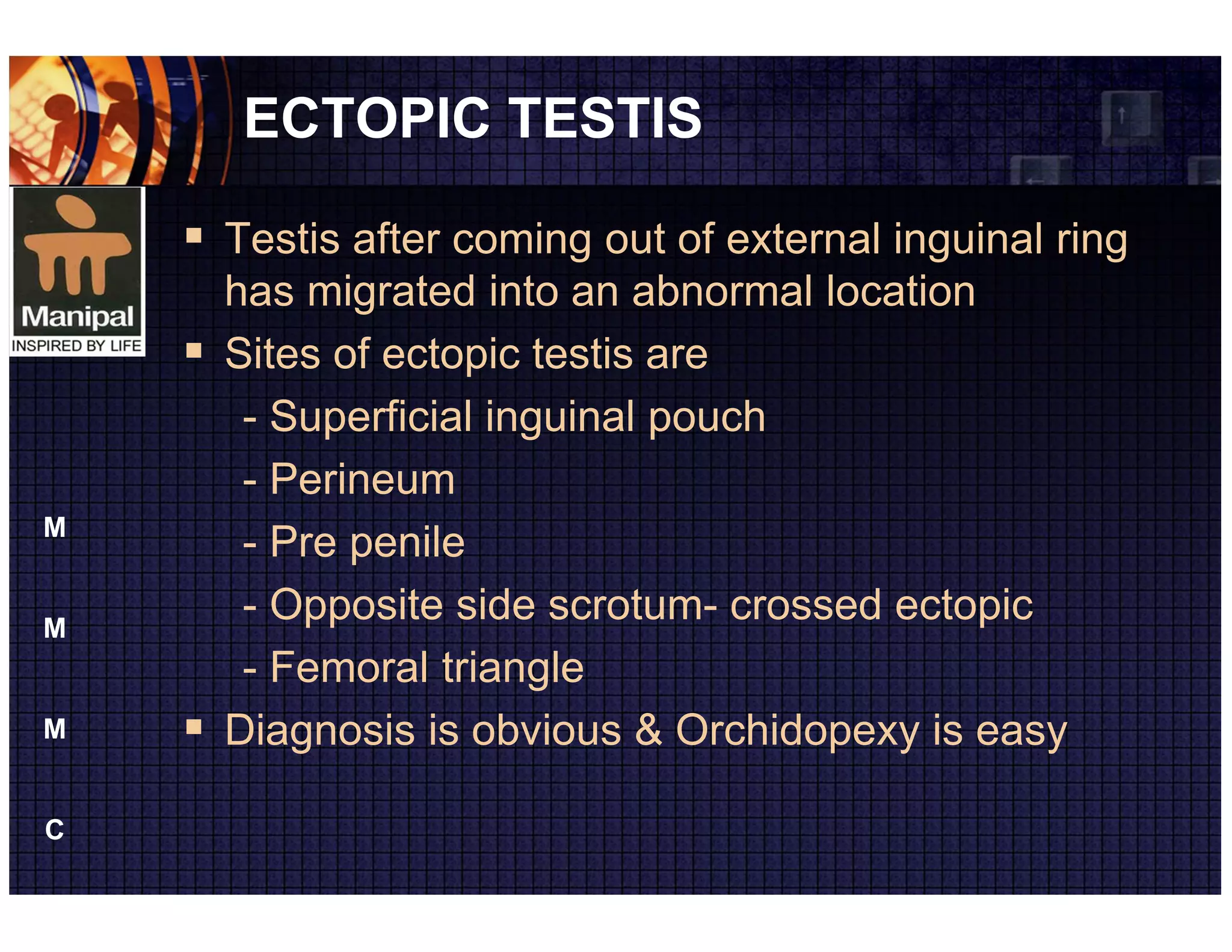 Cryptorchidism--(Undescended testis) | PDF