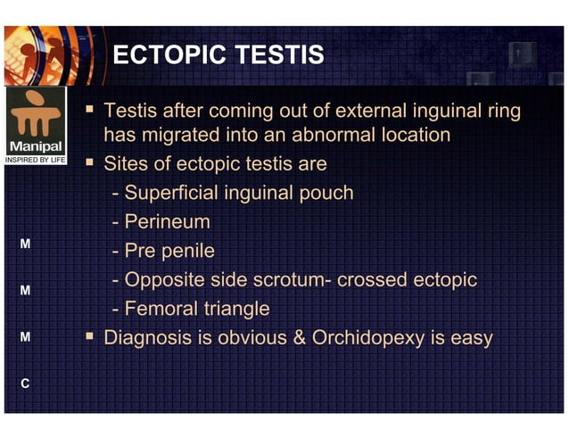 Cryptorchidism--(Undescended testis) | PPT
