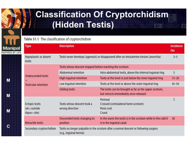 Cryptorchidism--(Undescended testis) | PDF